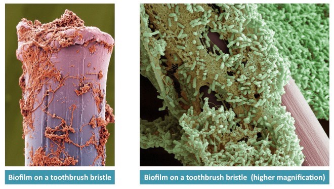 Biofilms | BioNinja