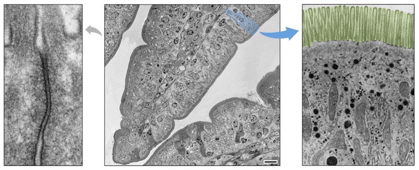 Digestive System Bioninja 32 Digestive System Diagram To Label